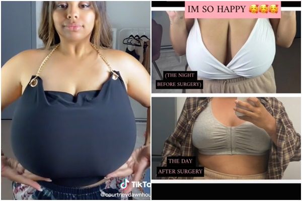 她挺44H「奶量太驚人」 無法呼吸超崩潰！砸50萬縮胸還有E罩杯 | ETtoday國際新聞 | ETtoday新聞雲