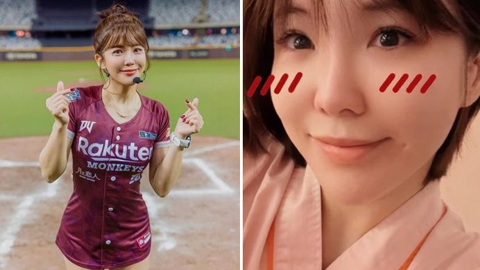 樂天女神壯壯「藏2周分享好消息」！跳到乾嘔…低調動手術：終於熬過 | ETtoday星光雲 | ETtoday新聞雲